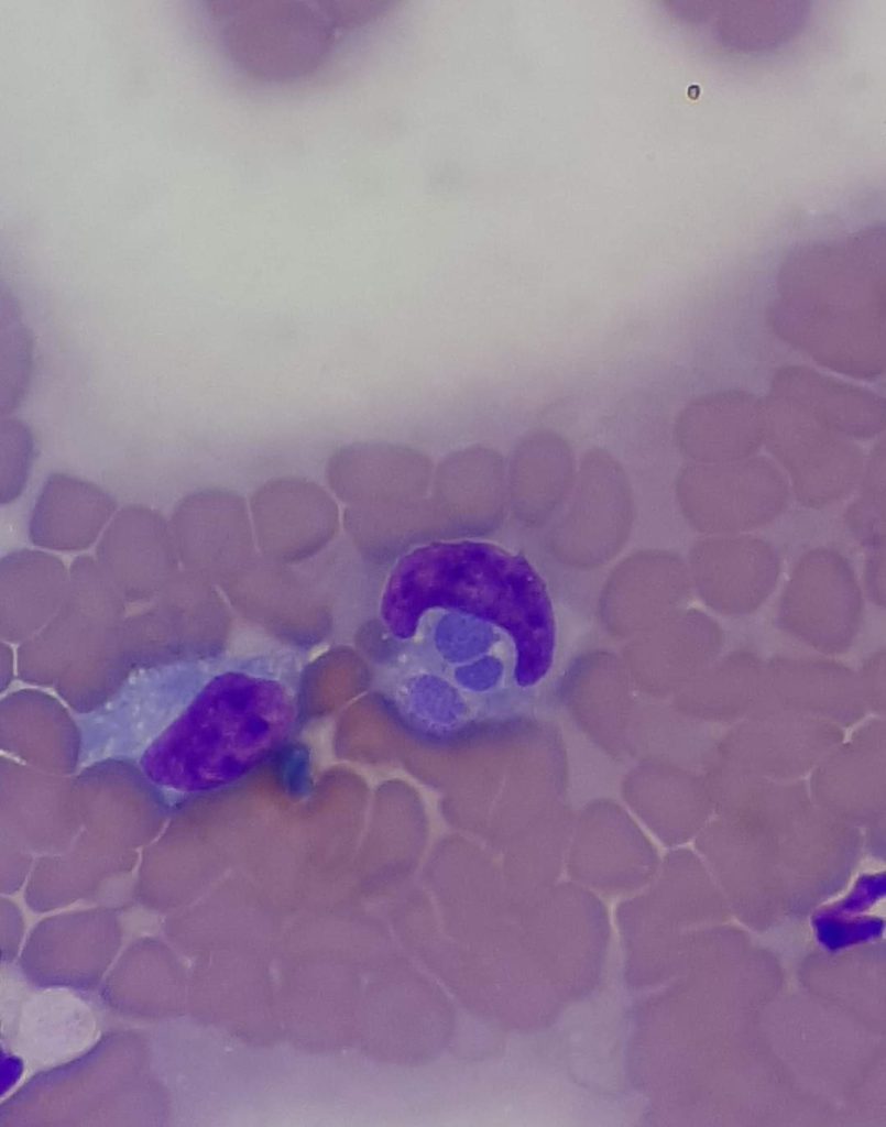 Mórulas de Ehrlichia – Grupo Zoovet