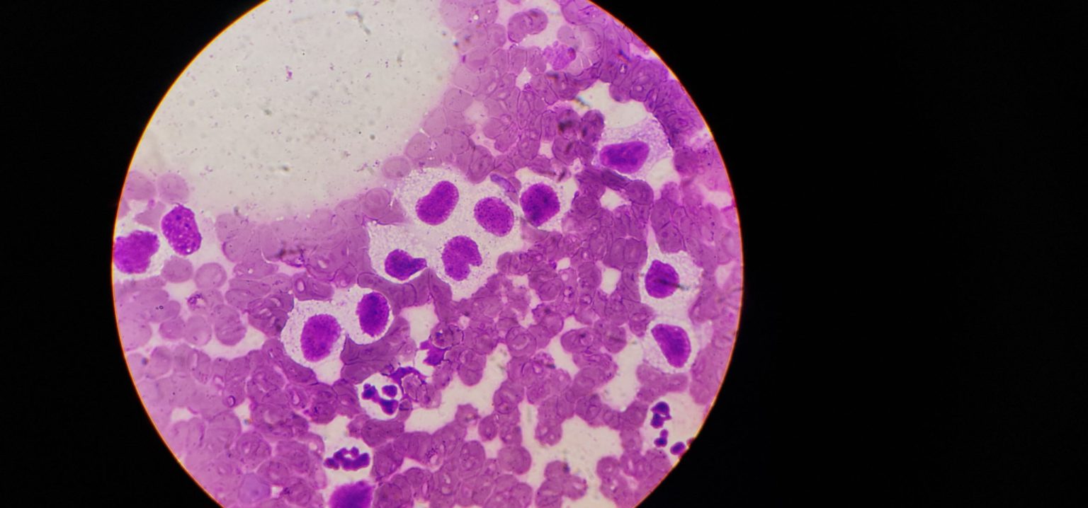 Mastocitoma – Grupo Zoovet