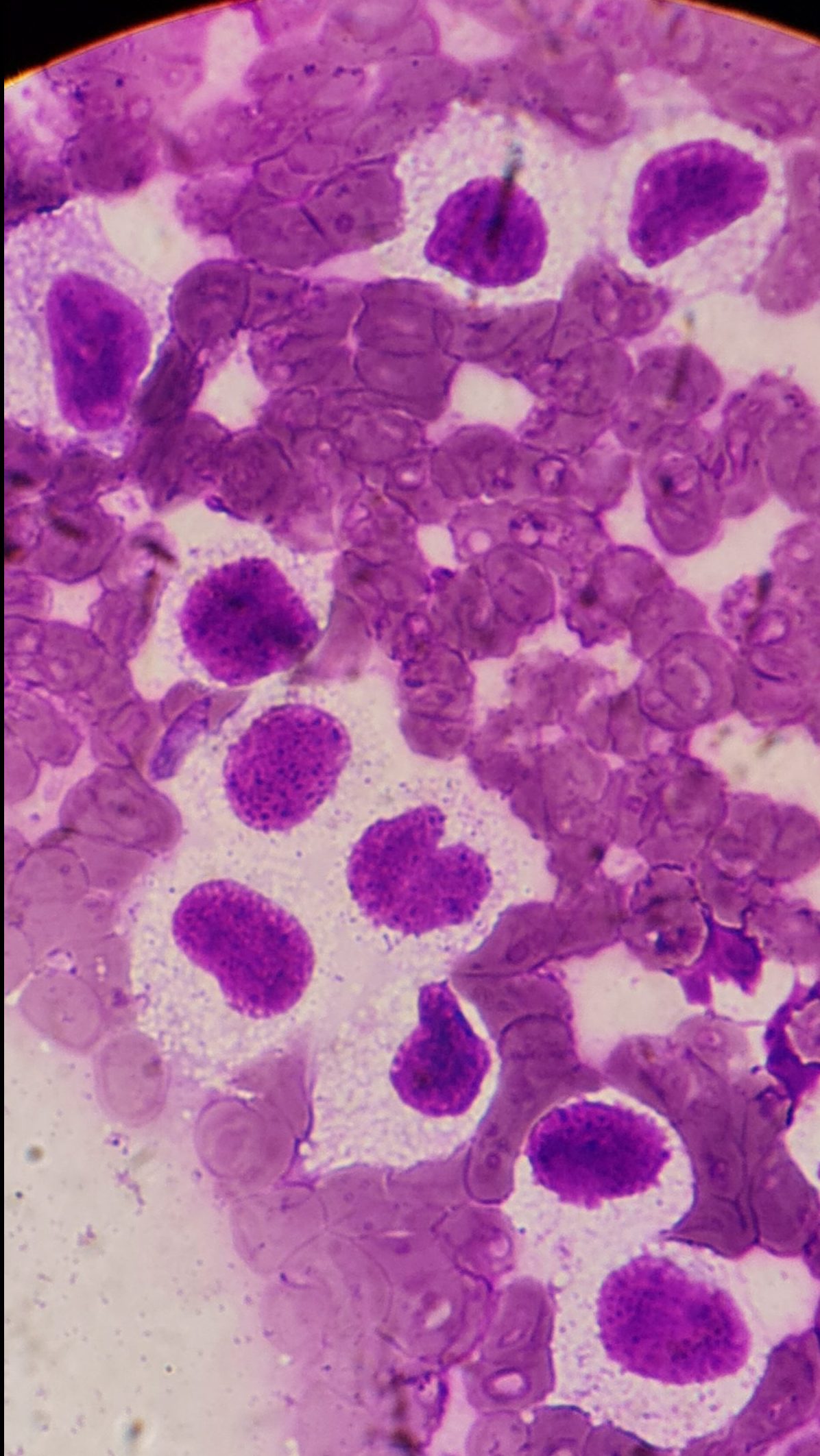 Mastocitoma – Grupo Zoovet