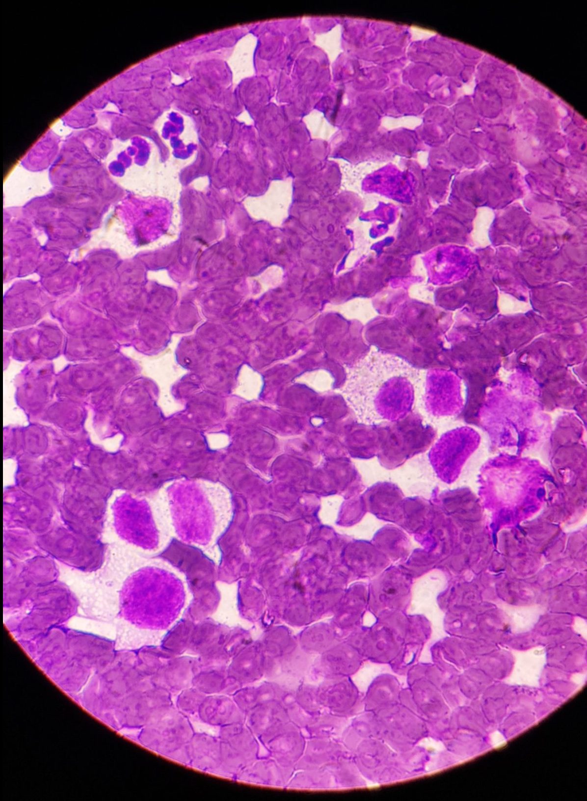 Mastocitoma – Grupo Zoovet